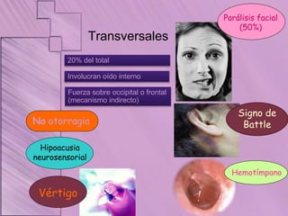 Fractura del Peñasco del Temporal Clase.pptx