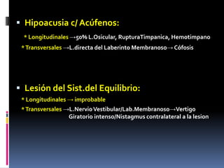 Fractura del peñasco Dr gabriel hinojosa | PPTX