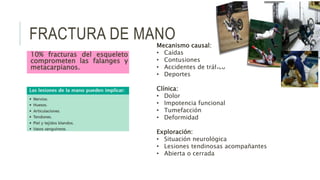 Fractura de mano | PPTX