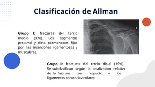 Fractura de Miembro Superior. MI Arlene Garca.pptx
