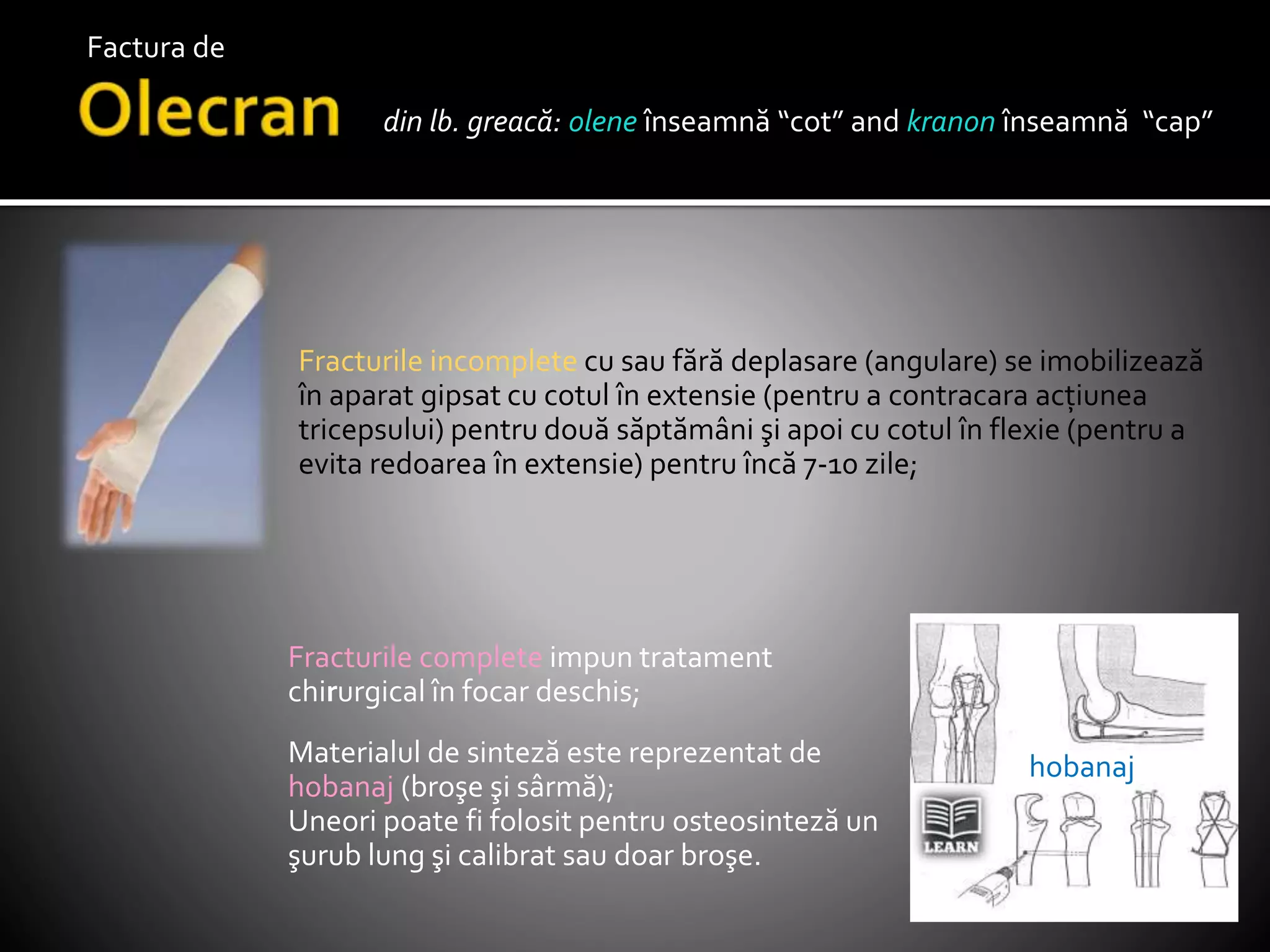 Fractura de olecran | PPTX
