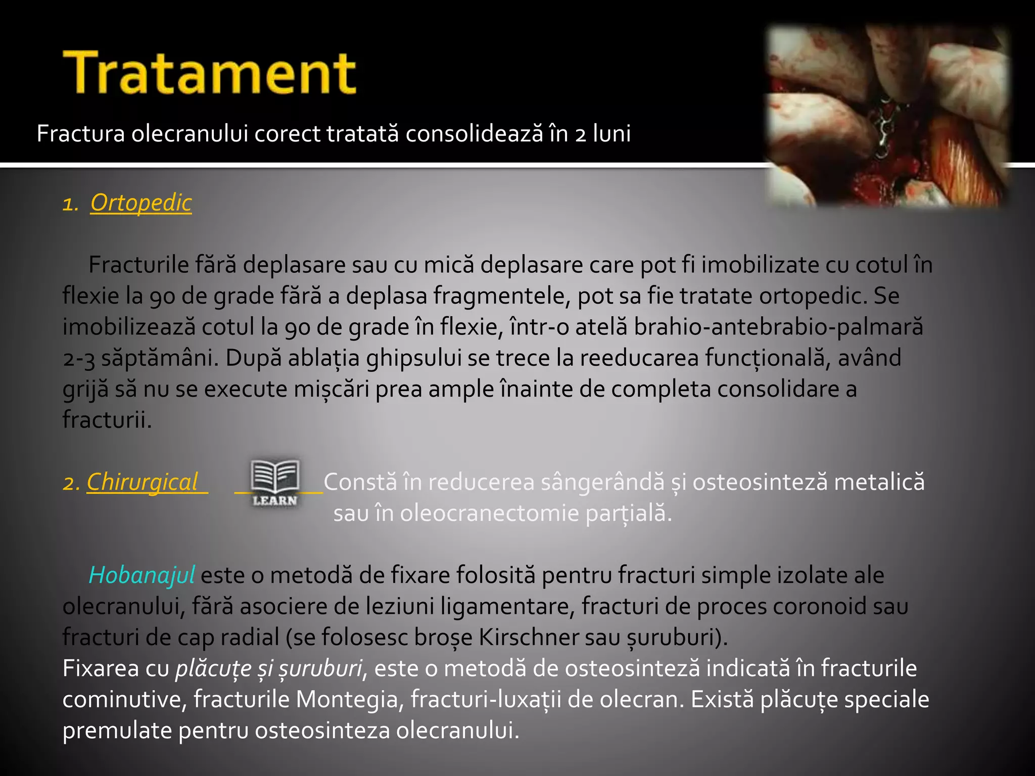 Fractura de olecran | PPTX