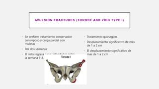 FRACTURA DE PELVIS .pptx