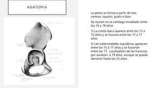 FRACTURA DE PELVIS .pptx