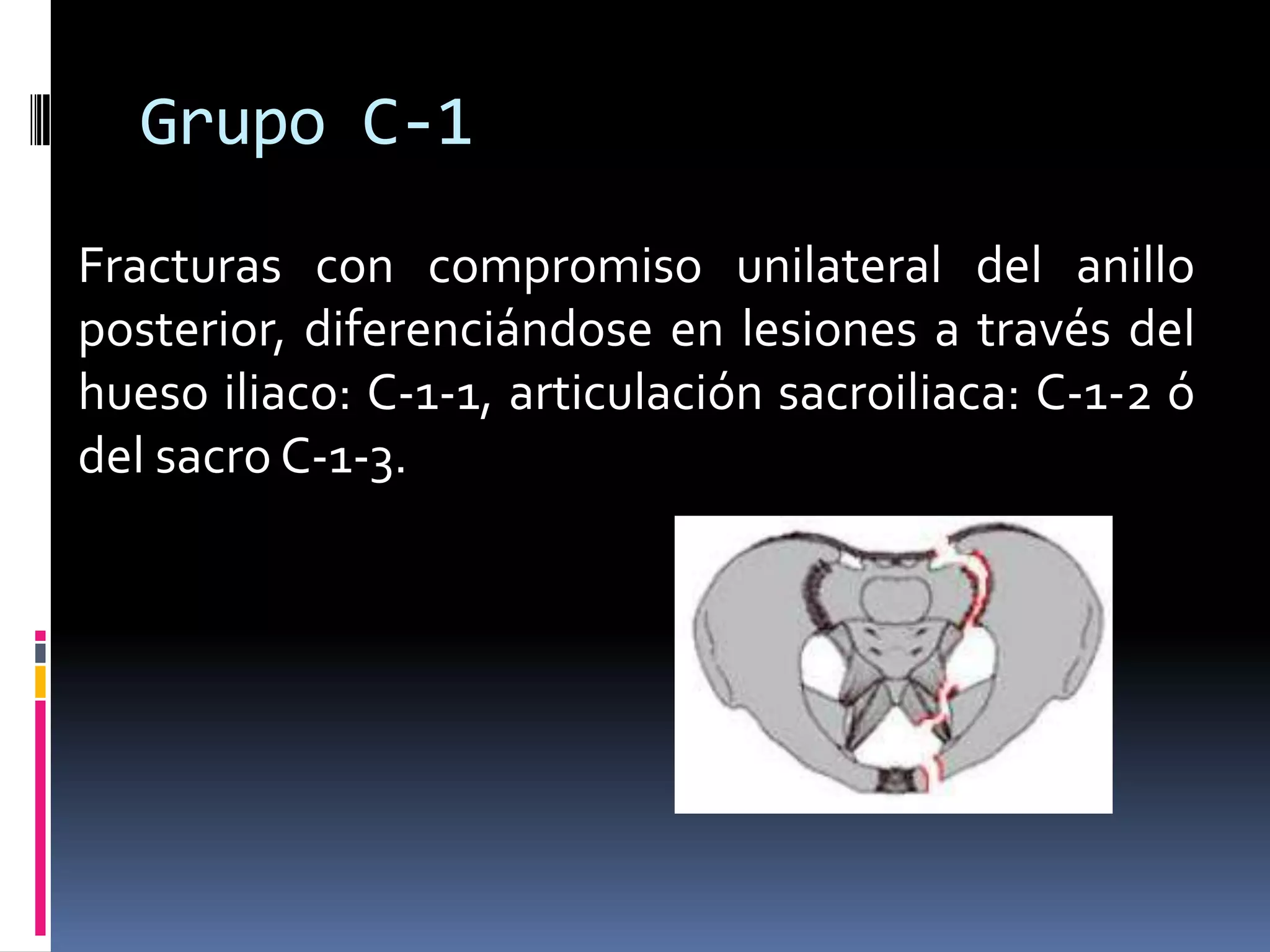 Fractura de pelvis trauma1total | PPTX