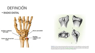 FRACTURA DE RADIO DISTAL AO- TRAUMATOLOGIA Y ORTOPEDIA.pptx