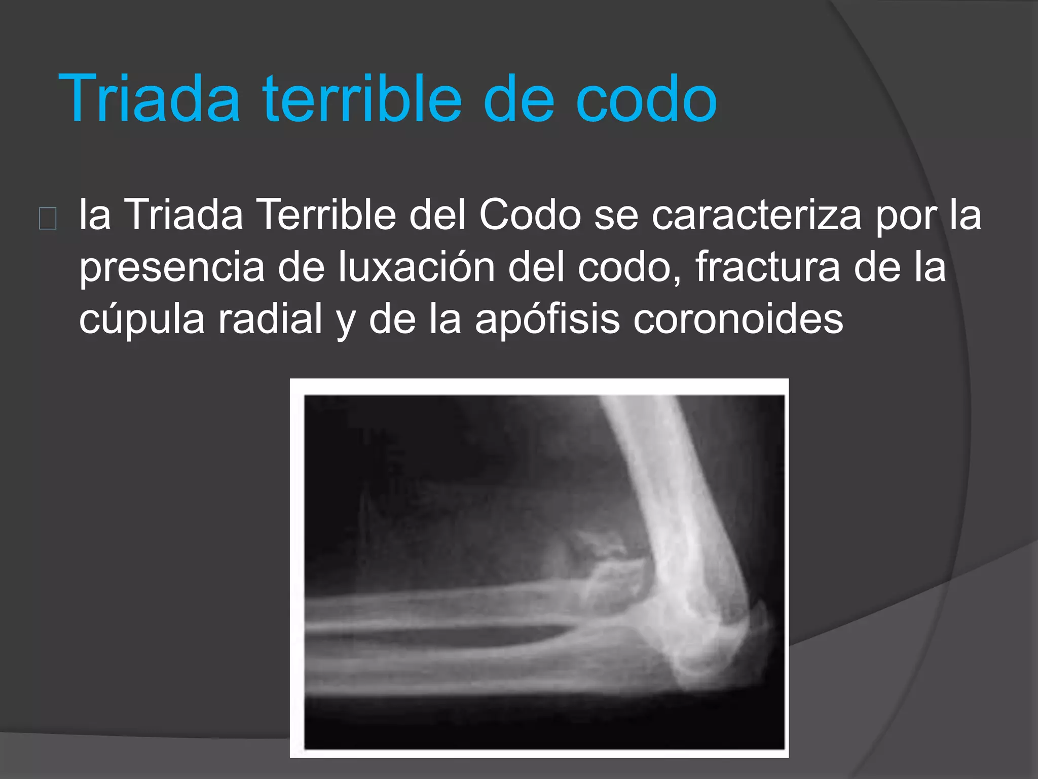 Fractura de radio y cubito proximal | PPTX