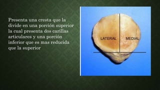 fractura de rotula TRAUAMTOLOGIA Y TYO.pptx