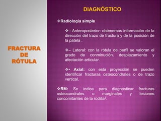 Fractura de rótula | PPTX