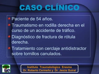 Fractura de rótula | PPT