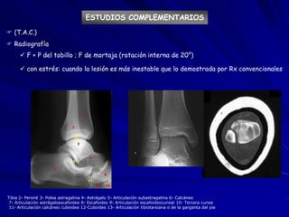 Fractura_de_tobillo.ppt