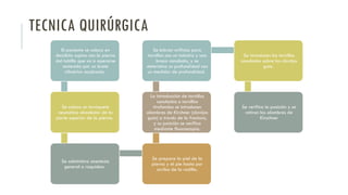 FRACTURA DE TOBILLO tenica qx en enfermeria.pptx