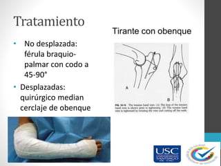 Fractura distal de antebrazo y brazo | PPTX