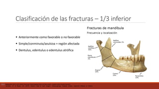 Fracturas faciales - Torrontegui | PDF