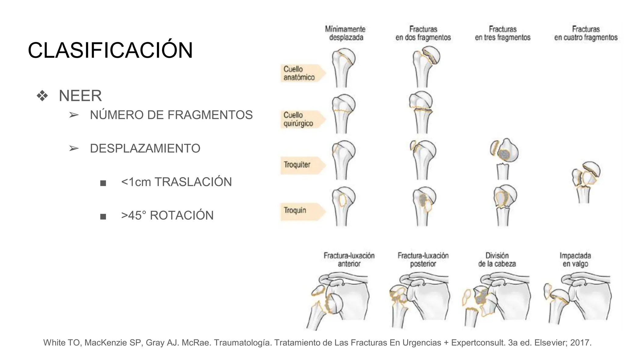 FRACTURA HUMERO PROXIMAL, ANATOMIA, DIAGNOSTICO Y TTO | PPTX