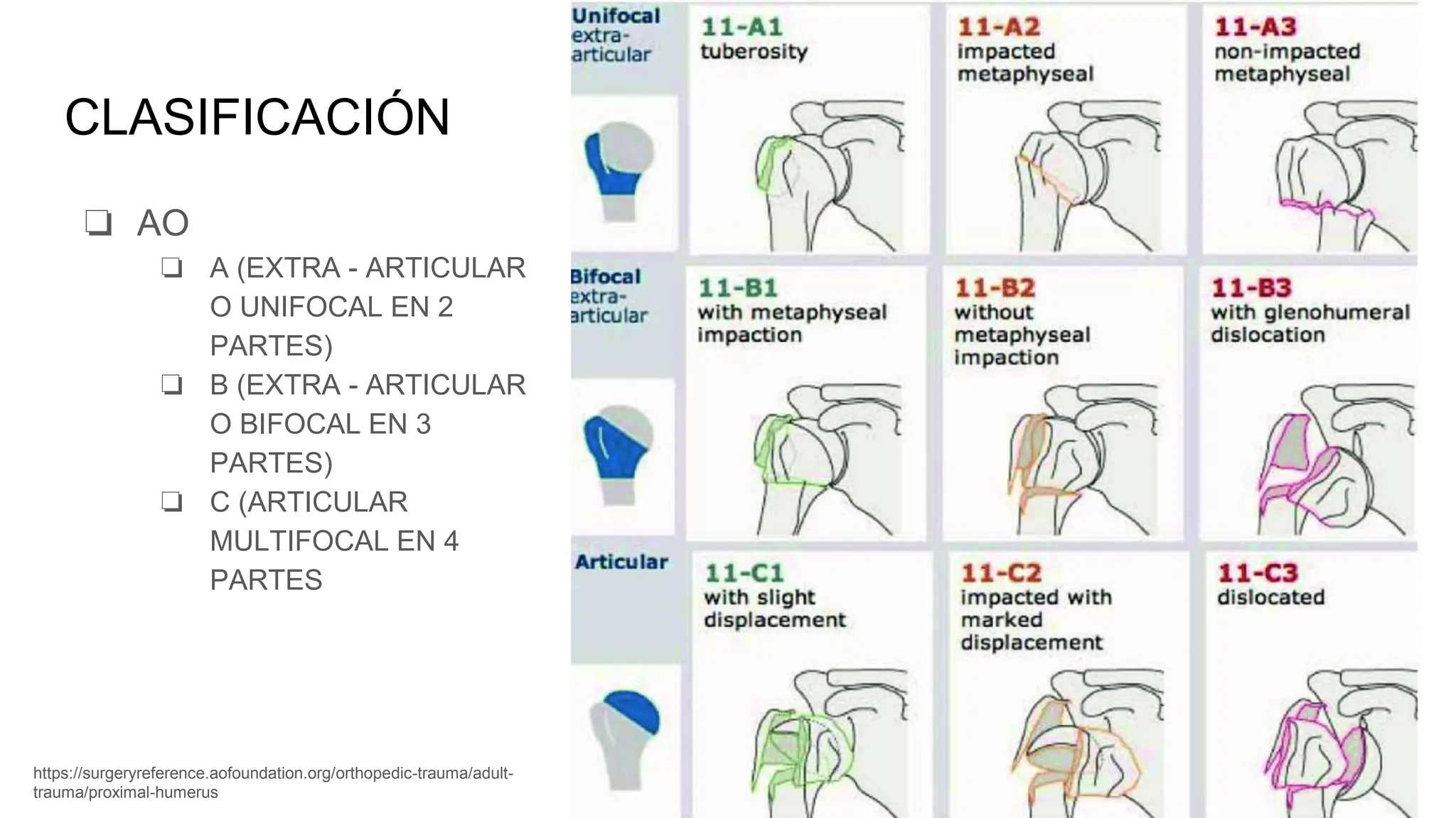 FRACTURA HUMERO PROXIMAL, ANATOMIA, DIAGNOSTICO Y TTO | PPTX