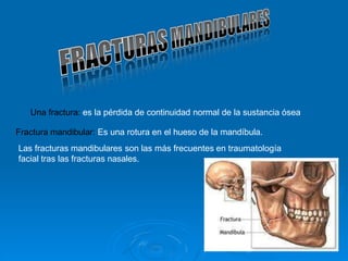 fracturamandibular-091113130504-phpapp01 (1).pptx