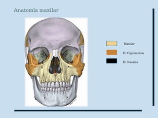Fractura maxilar | PPTX