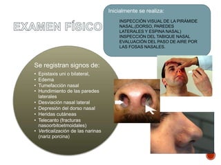 FRACTURA NASAL.pptx