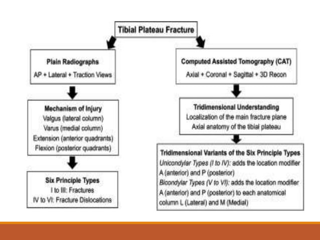 Fractura platillo tibial | PPT
