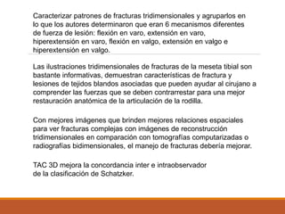 Fractura platillo tibial | PPTX