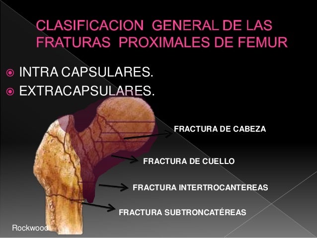 Fractura proximal de femur. vias de abordaje 27.5.15