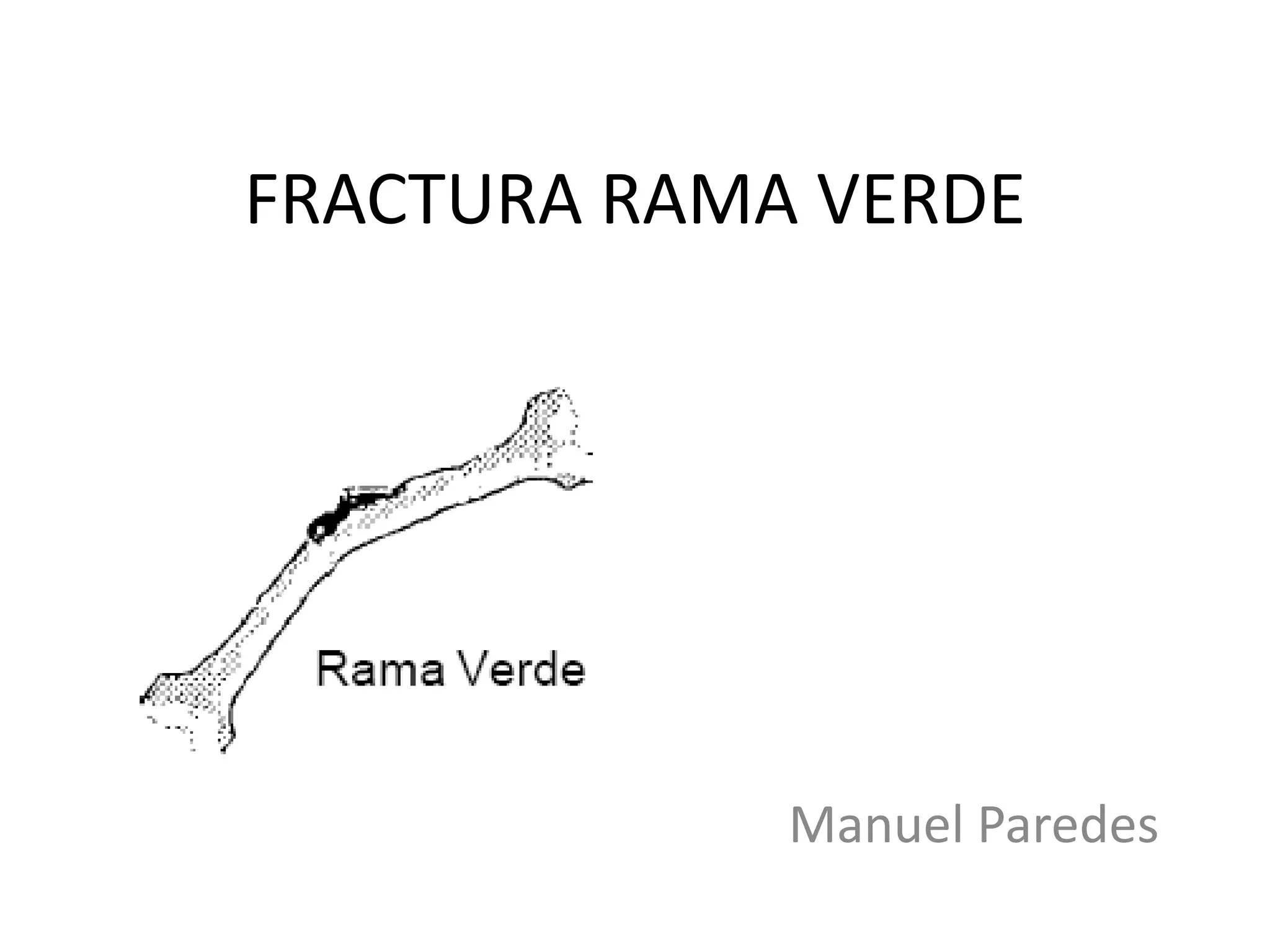 Fractura rama verde | PPTX | Death, Injury, or Military Conflict ...