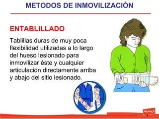 Fracturas | PPT