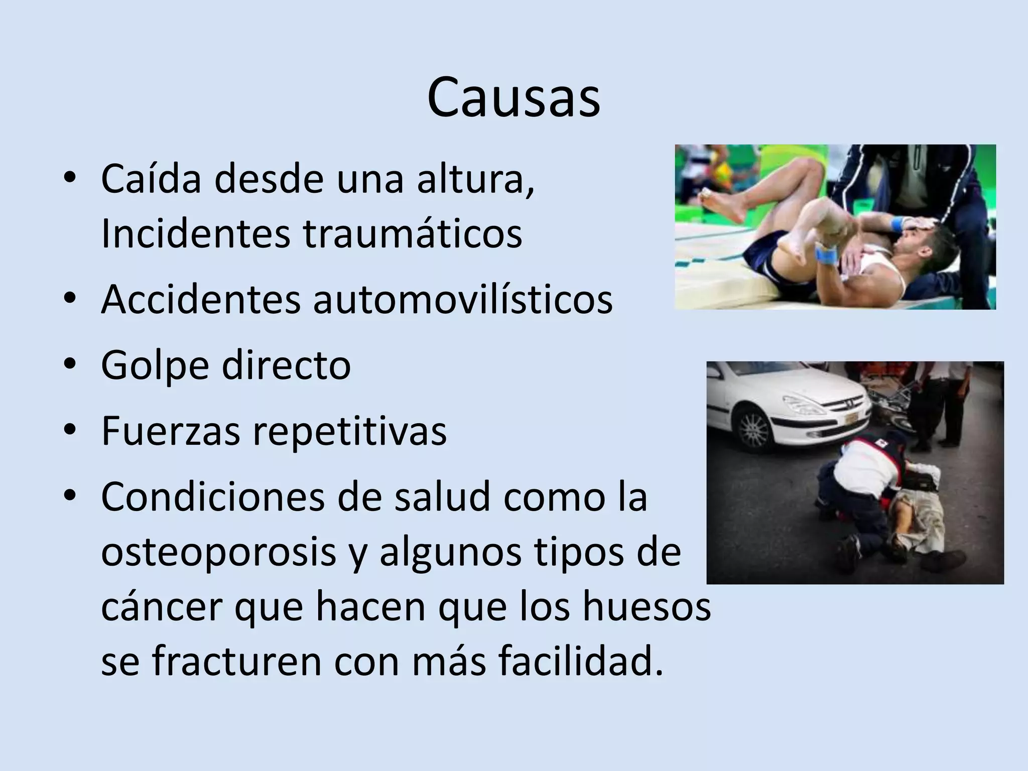 Fracturas | PPTX