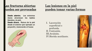 fracturas-abiertas ortopedia.pptx exposición internado | PPTX