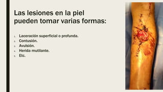 fracturas-abiertas ortopedia.pptx exposición internado | PPTX
