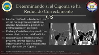 Fracturas cigomaticas | PPTX