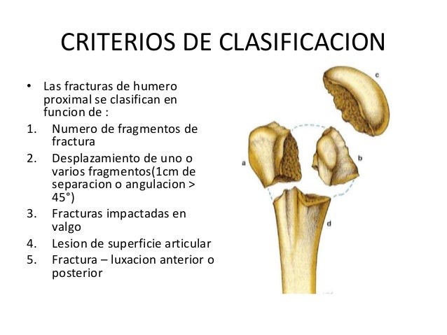 Fracturas complejas de humero proximal