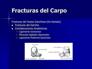 Fracturas de antebrazo y muñeca | PPTX