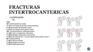 Fracturas de cadera | PPTX