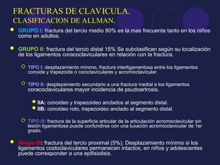 FRACTURAS DE CLAVICULA 4to año medicina.ppt