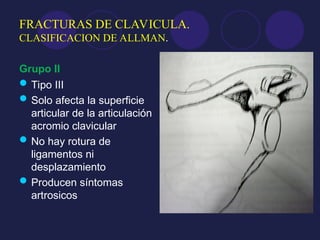 FRACTURAS DE CLAVICULA 4to año medicina.ppt