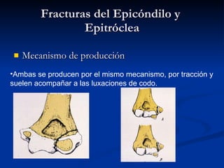 Fracturas De C O D O | PPT