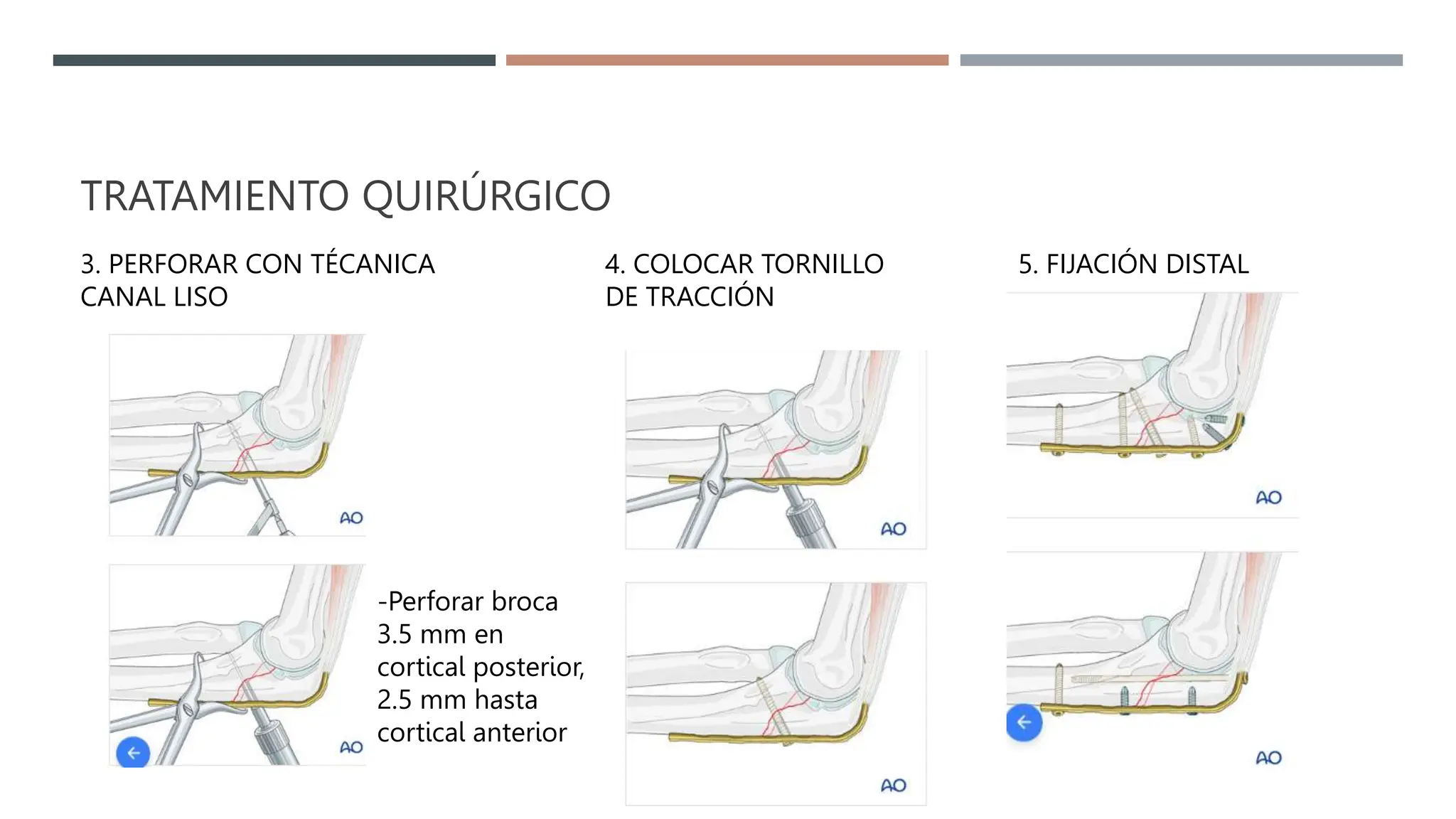 FRACTURAS DE RADIO Y CUBITO PROXIMAL CODO.pptx