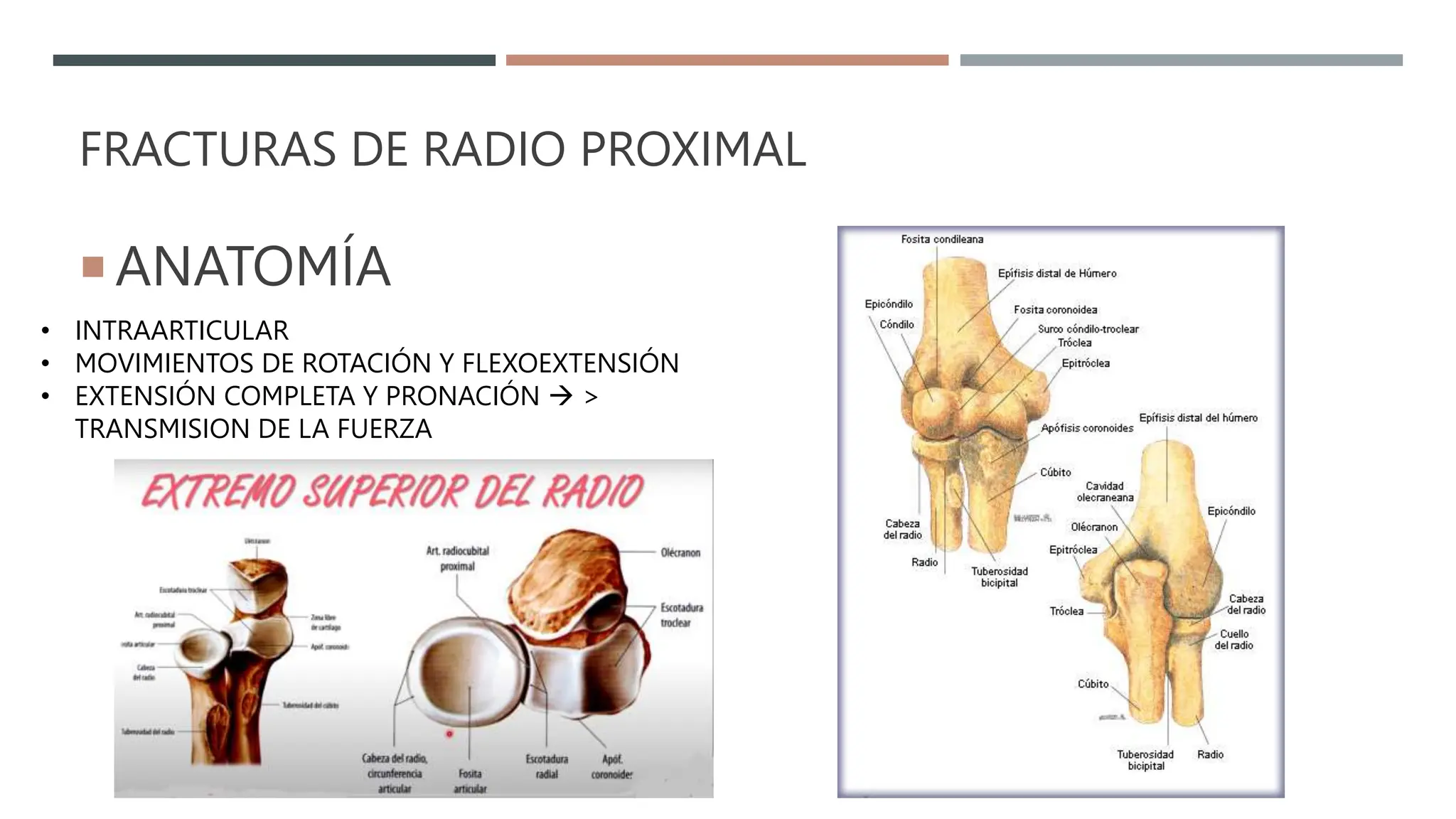 FRACTURAS DE RADIO Y CUBITO PROXIMAL CODO.pptx