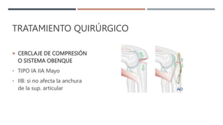 fracturas proximales del cubito y radio.pdf