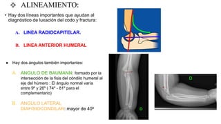 Fracturas de codo en niños tratamiento .pdf