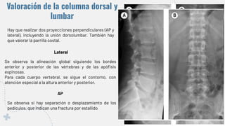 Fracturas de columna Y pelvis sobre huesas | PDF