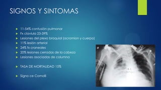 Fracturas de escapula | PPTX