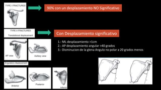 Fracturas de Escapula.pptx
