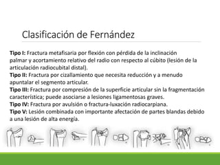 Fracturas De Ex Wps Office Tercio Distal Pptx