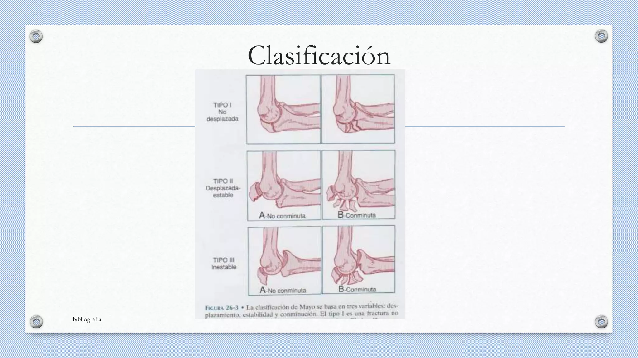 FRACTURAS DE EXTREMO PROXIMAL DE CUBITO Y RADIO hospital.pptx
