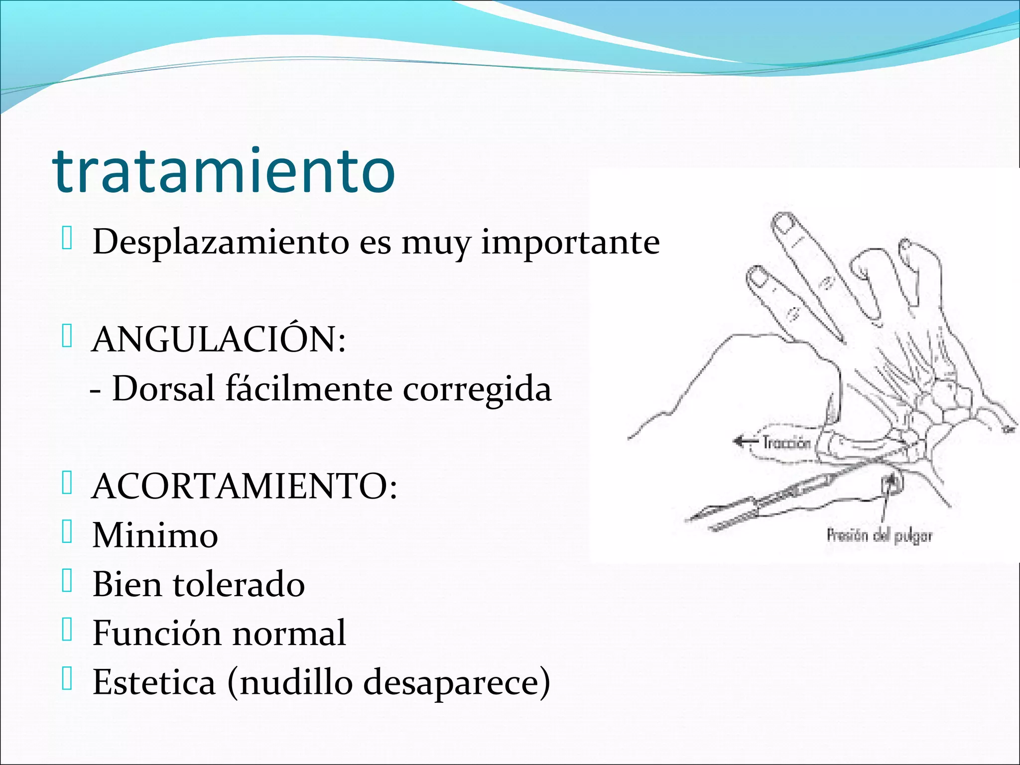 Fracturas de falanges completa 2 | PPT | First Aid | Injuries
