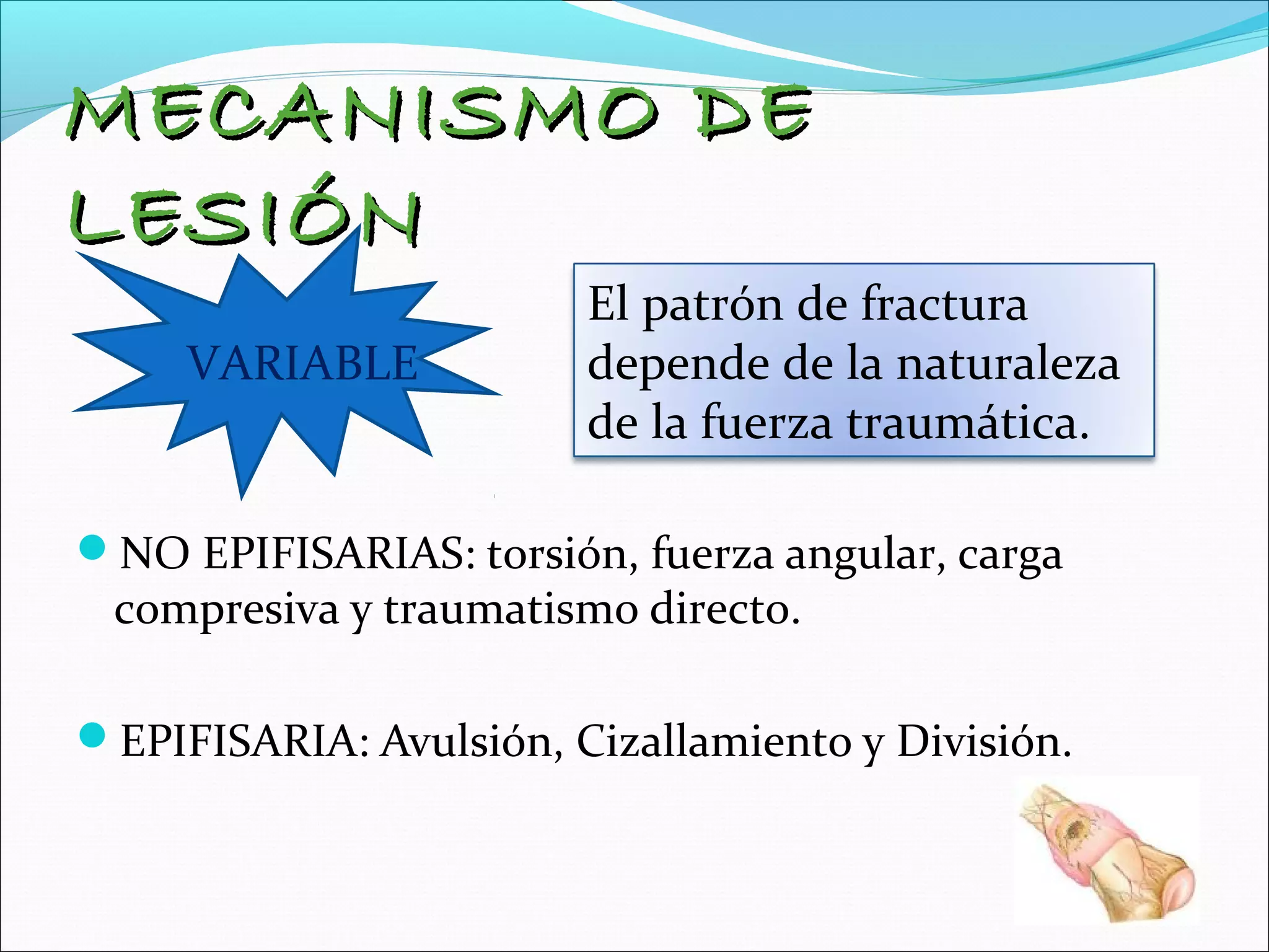 Fracturas de falanges completa 2 | PPT | First Aid | Injuries