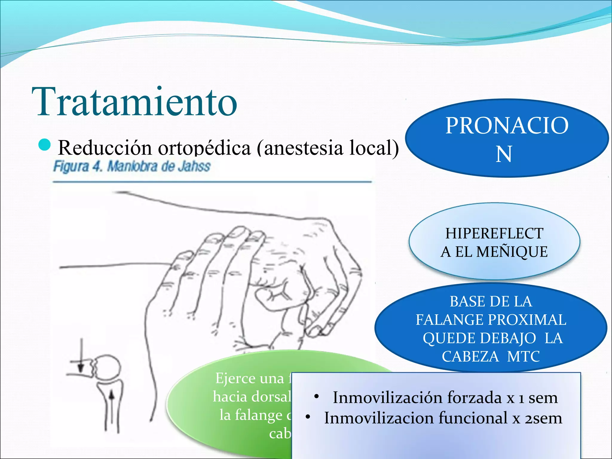 Fracturas de falanges completa 2 | PPT | First Aid | Injuries